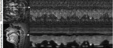 Software | Laboratory of Quantitative and Dynamic Magnetic Resonance ...