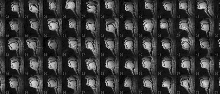 Laboratory of Quantitative and Dynamic Magnetic Resonance Imaging | The ...